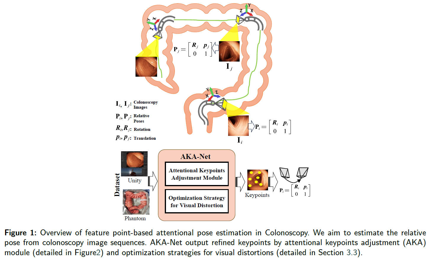AKA-Net: A Self-supervised Colonoscopy Pose Estimation Method with Attentional Keypoints ...